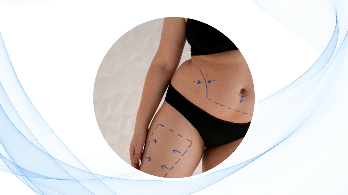 Rosácea: Diagnóstico, Subtipos y Estrategias de Tratamiento