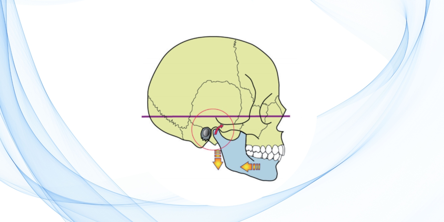 Condilografía: analizando la dirección del cóndilo mandibular como guía ...