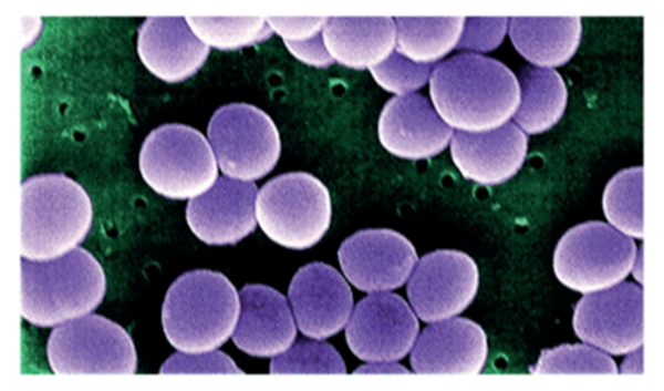 Infecciones por Estafilococo Aureus: Lo que todo especialista necesita ...